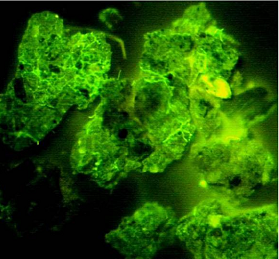 Glomalin - A Natural Soil Amendment Made By VA (Endo) Mycorrhizal Fungi ...